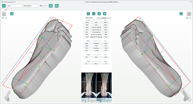 ScanPod3D 3D Laser Foot Scanner | Orthotic Insole CAD & CAM ...