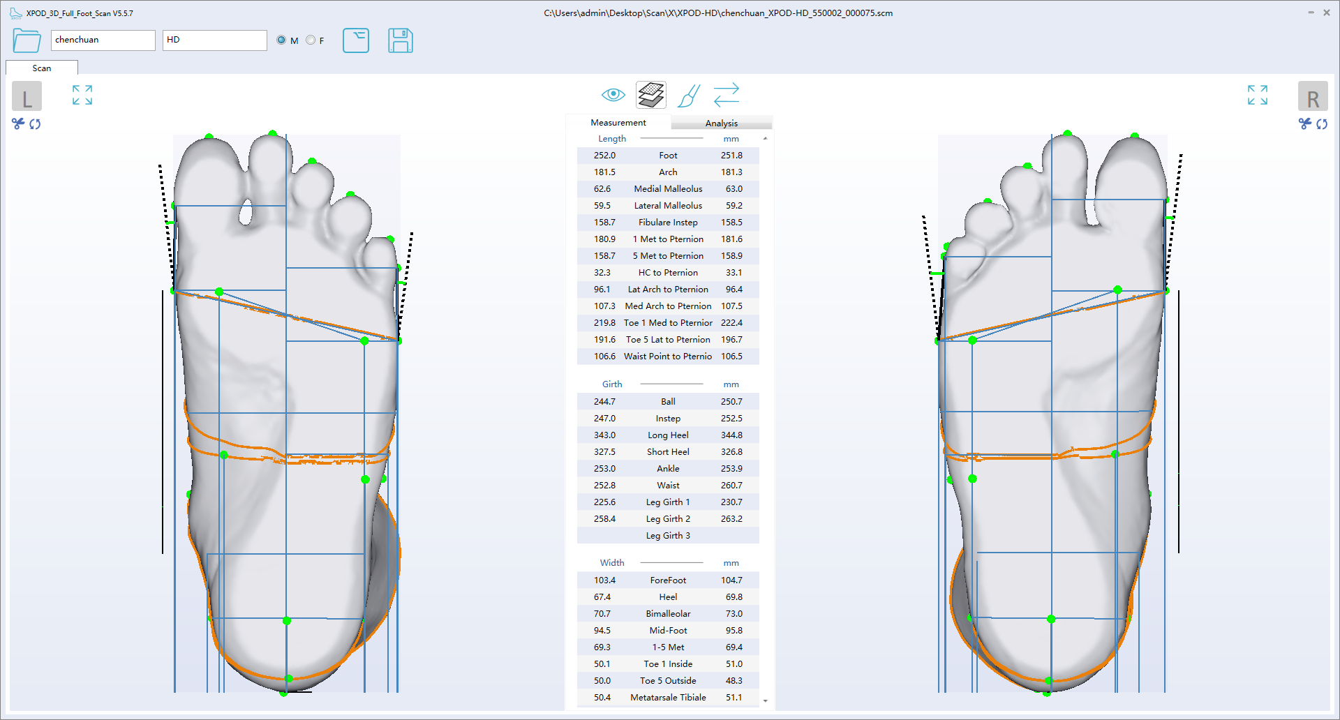 ScanPod3D 3D Laser Foot Scanner | Orthotic Insole CAD & CAM ...