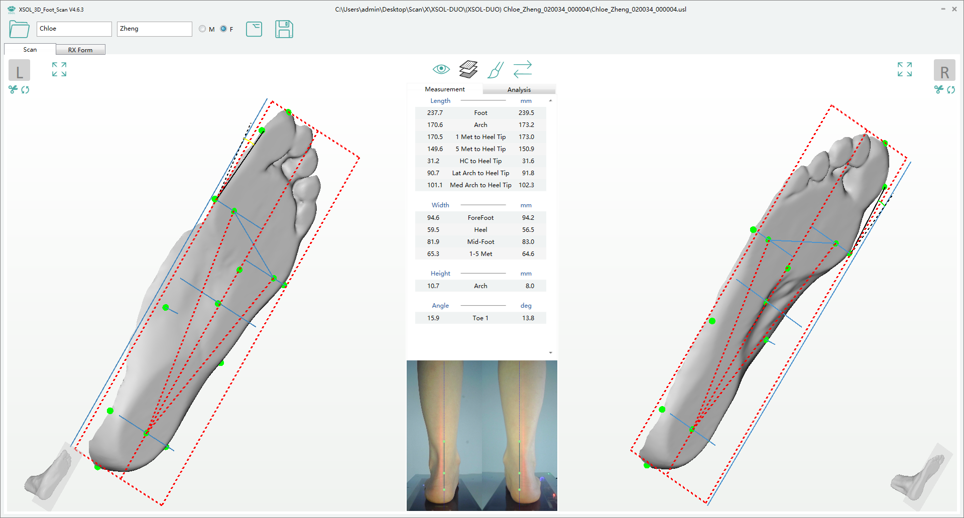 ScanPod3D 3D Laser Foot Scanner | Orthotic Insole CAD & CAM ...