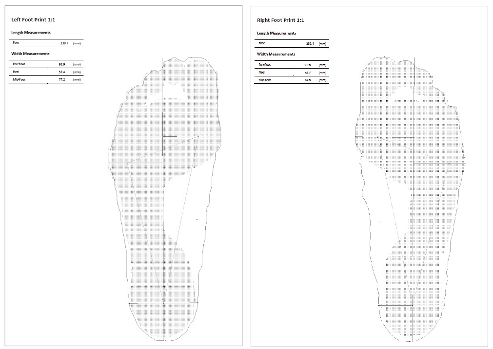 ScanPod3D 3D Laser Foot Scanner | Orthotic Insole CAD & CAM ...