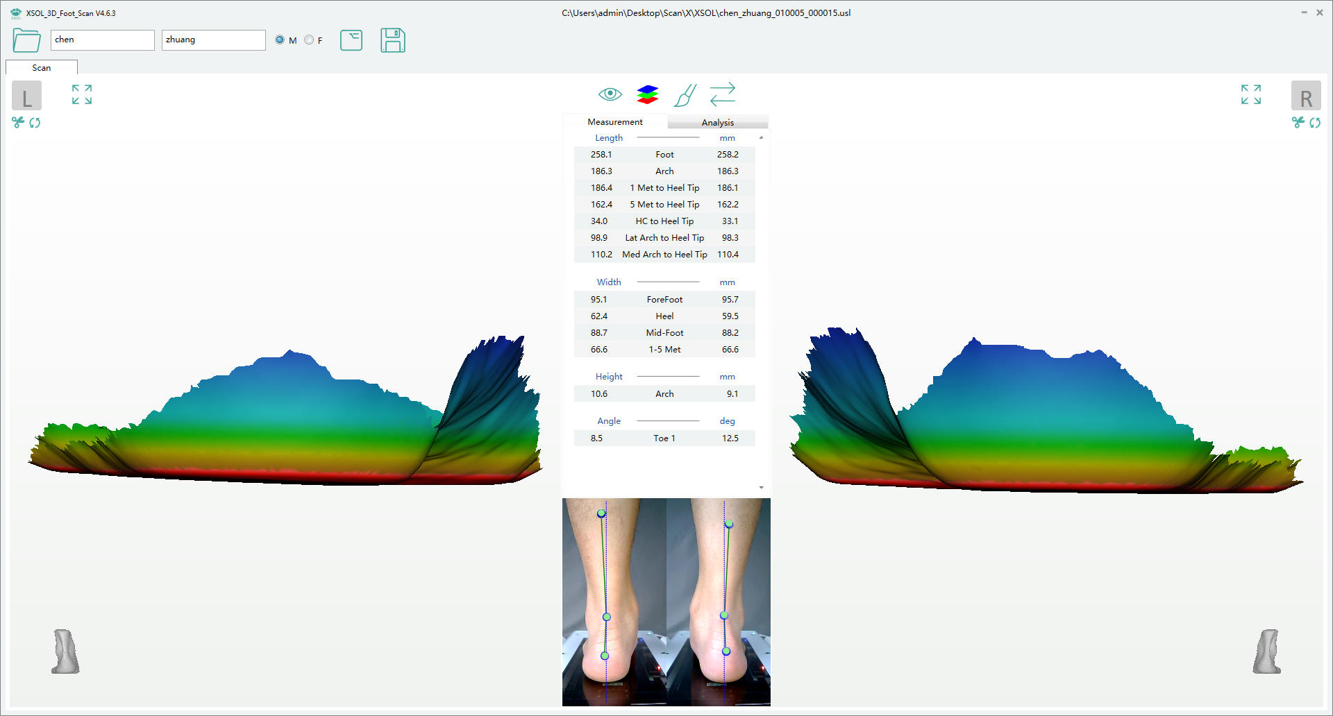 ScanPod3D 3D Laser Foot Scanner | Orthotic Insole CAD & CAM ...
