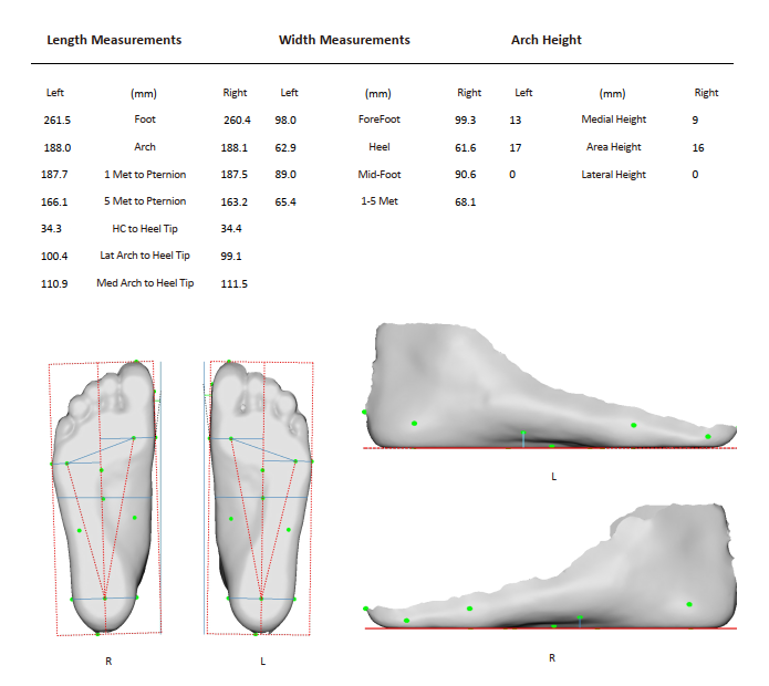ScanPod3D 3D Laser Foot Scanner | Orthotic Insole CAD & CAM ...