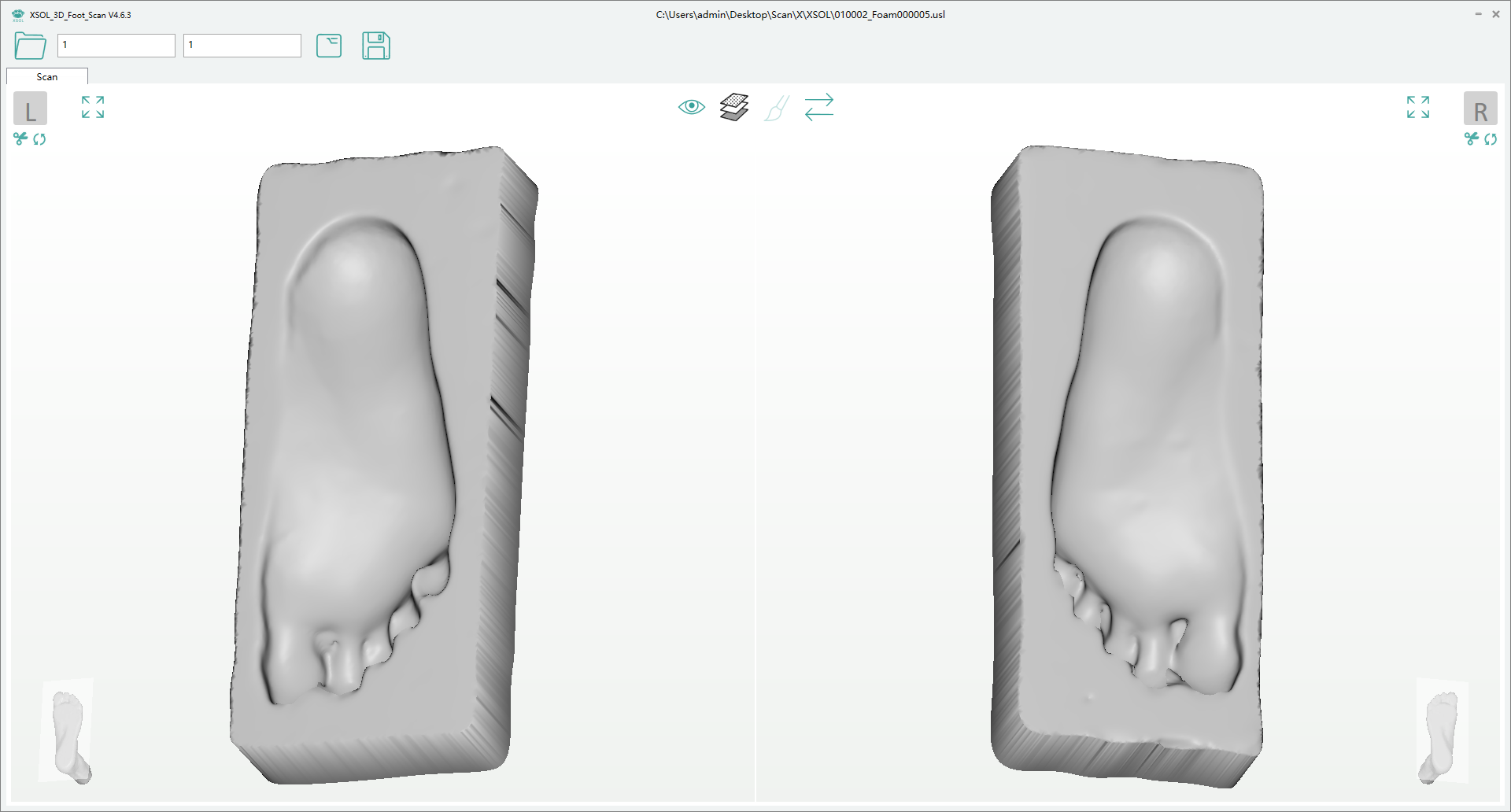 ScanPod3D 3D Laser Foot Scanner | Orthotic Insole CAD & CAM ...