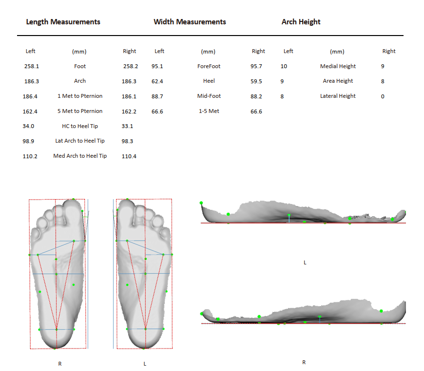 ScanPod3D 3D Laser Foot Scanner | Orthotic Insole CAD & CAM ...