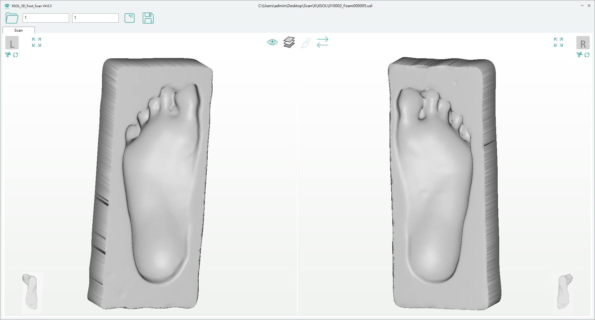 ScanPod3D 3D Laser Foot Scanner | Orthotic Insole CAD & CAM ...