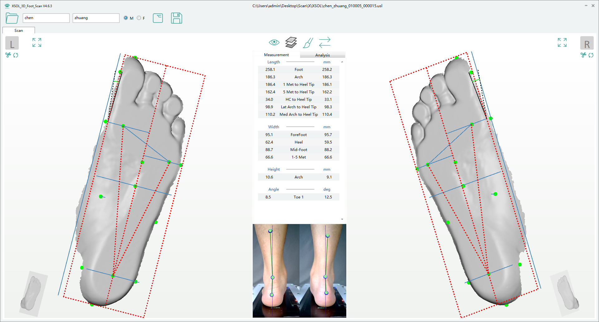 ScanPod3D 3D Laser Foot Scanner | Orthotic Insole CAD & CAM ...