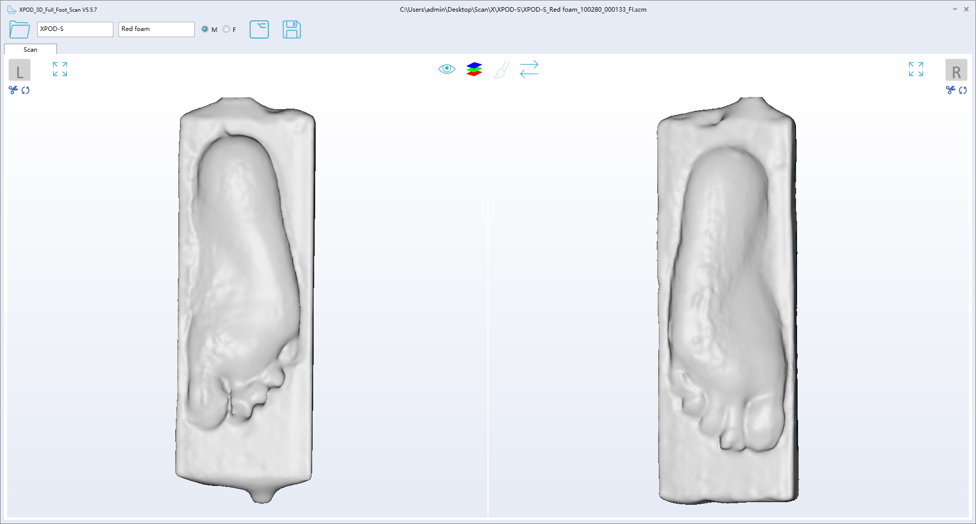 ScanPod3D 3D Laser Foot Scanner | Orthotic Insole CAD & CAM ...