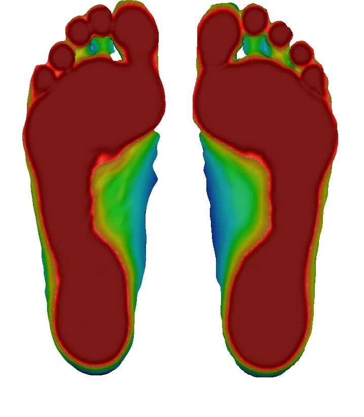 ScanPod3D 3D Laser Foot Scanner | Orthotic Insole CAD & CAM ...