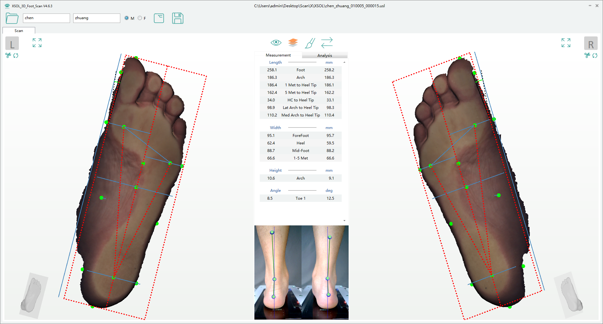 ScanPod3D 3D Laser Foot Scanner | Orthotic Insole CAD & CAM ...