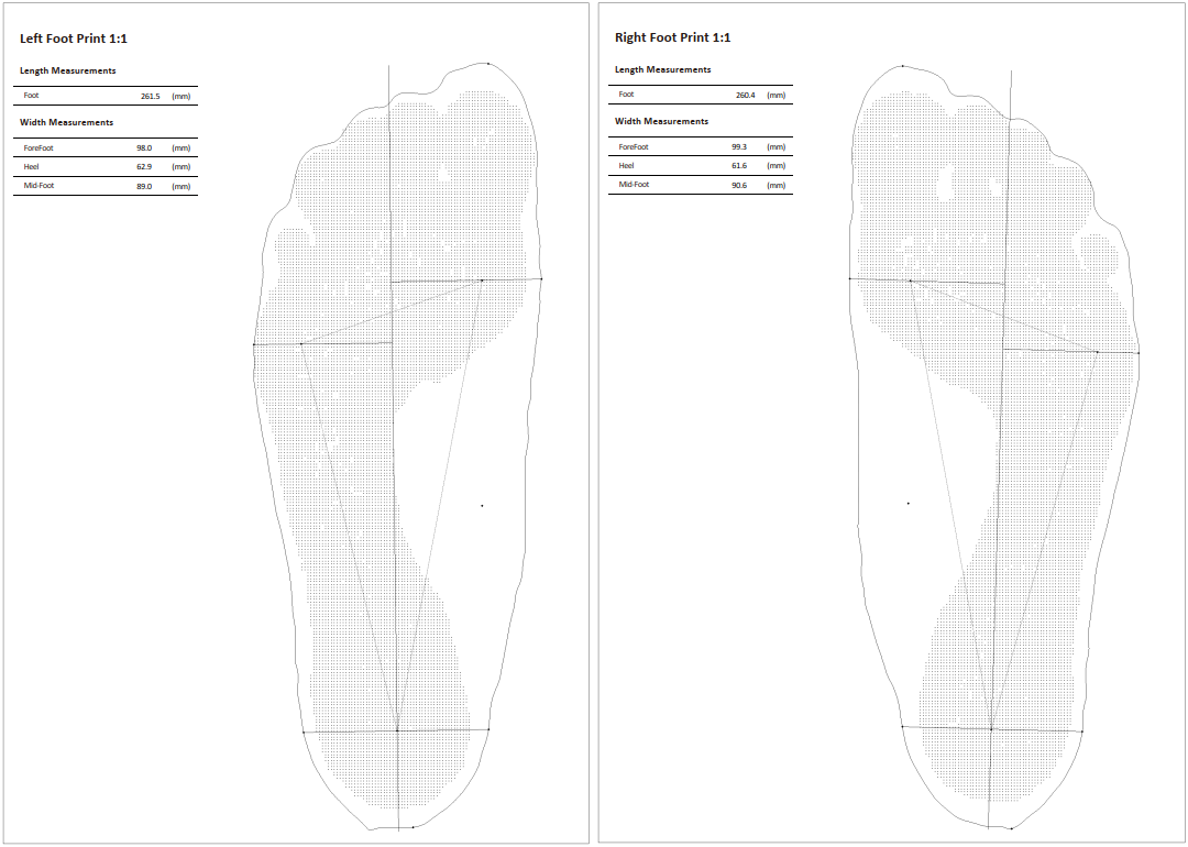 ScanPod3D 3D Laser Foot Scanner | Orthotic Insole CAD & CAM ...